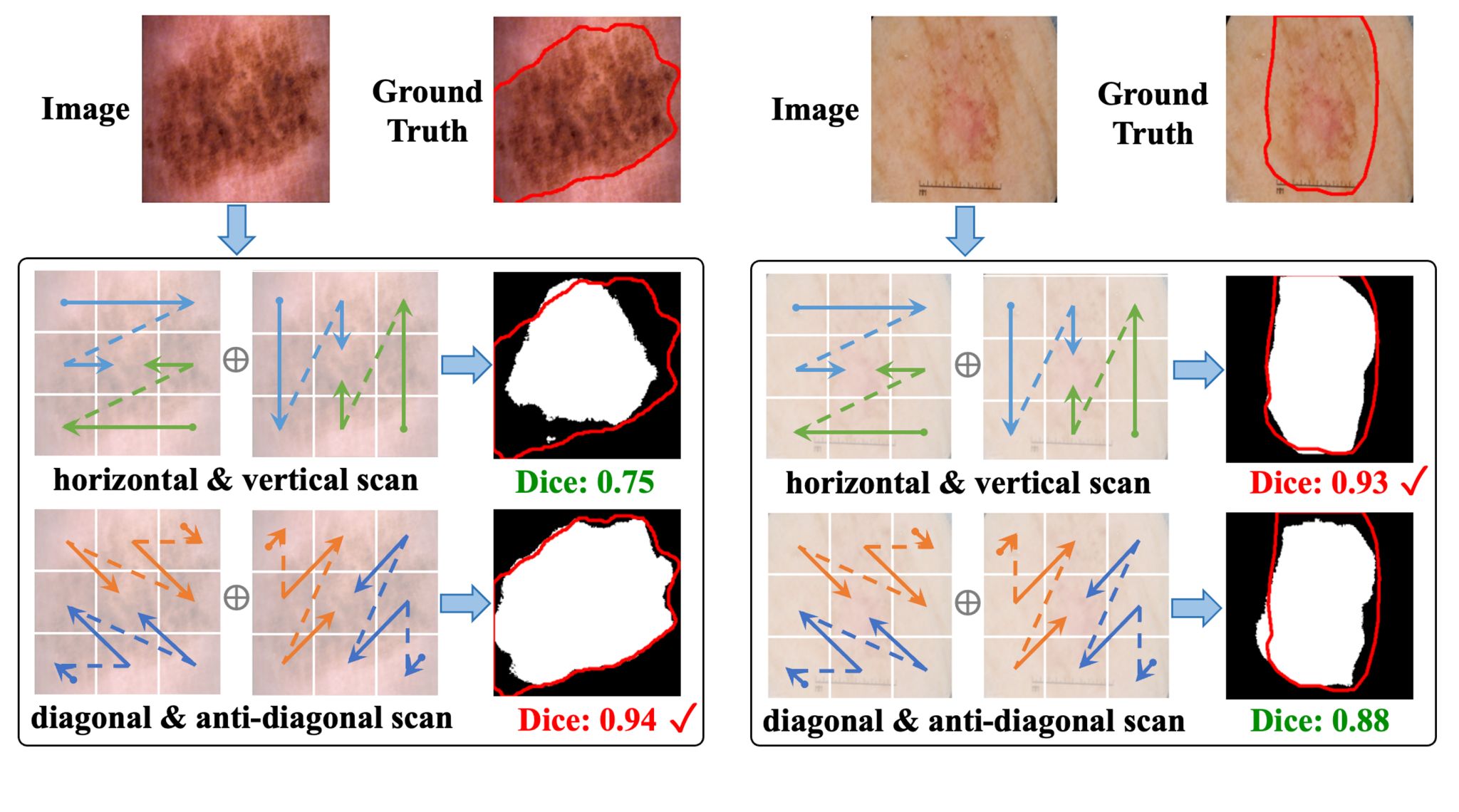 Diversity-enhanced Collaborative Mamba for Semi-supervised Medical Image Segmentation