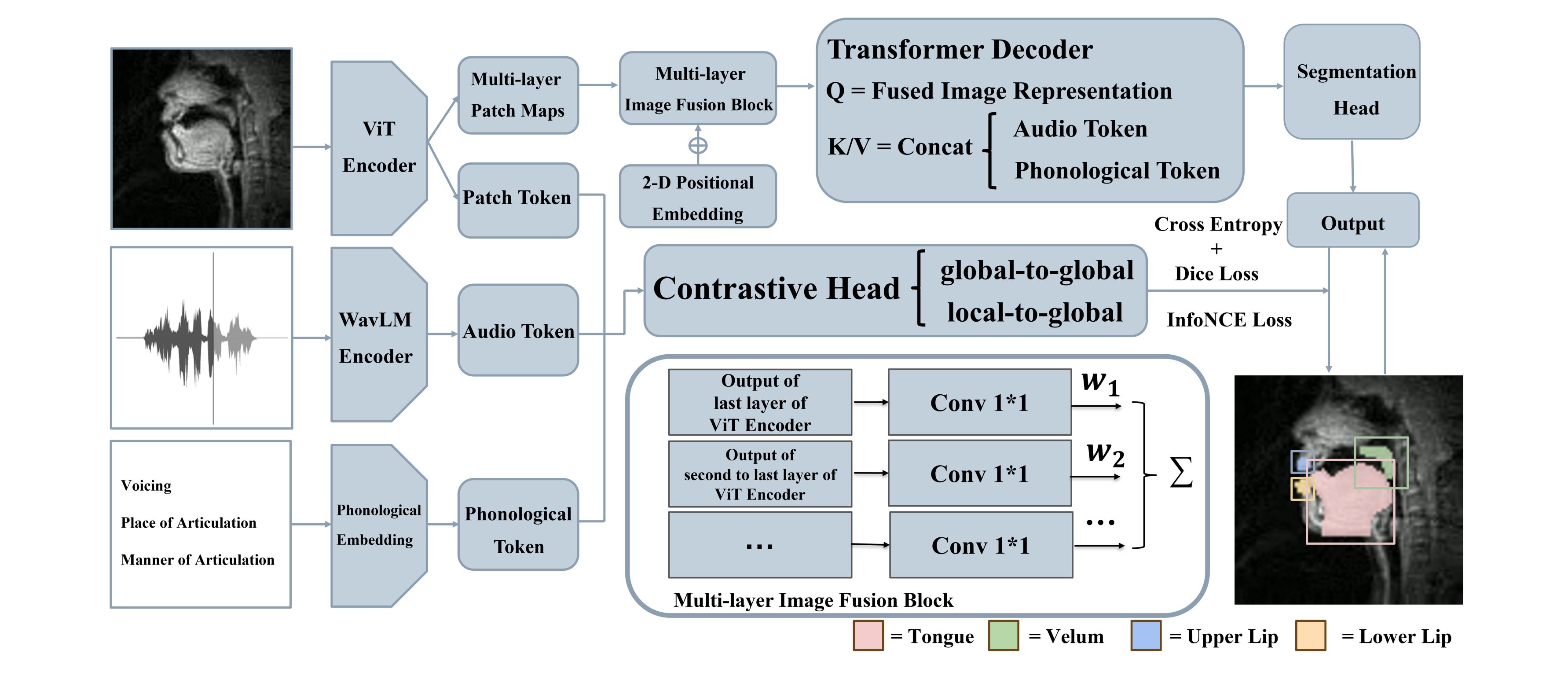 VocSegMRI: Multimodal Learning for Precise Vocal Tract Segmentation in Real-time MRI